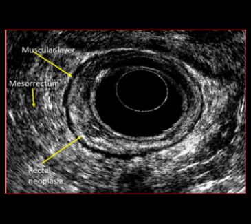 Our Facilities | Colorectal Clinic Associates (Malaysia)